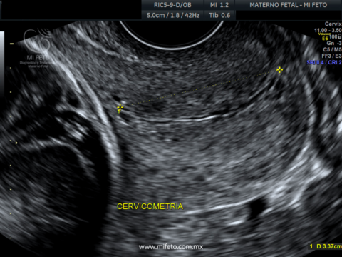 Ultrasonido Estructural - Mi Feto