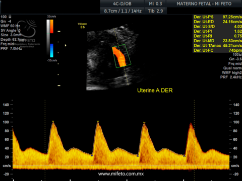 Ultrasonido Estructural - Mi Feto